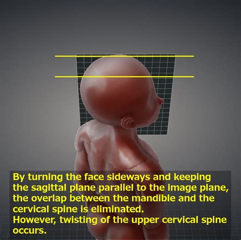 Cervical Spine Oblique ViewTools For RadTech