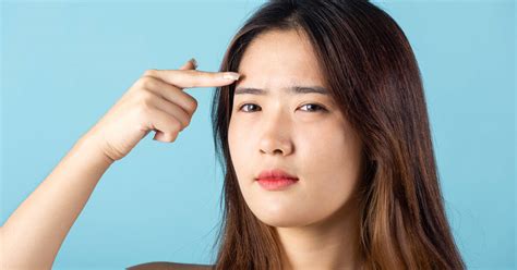 Bump On Forehead Possible Causes And Treatments