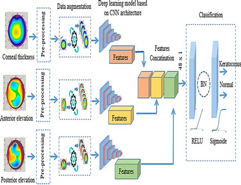 The Proposed Keratoconus Detection Approach Architecture Download Scientific Diagram