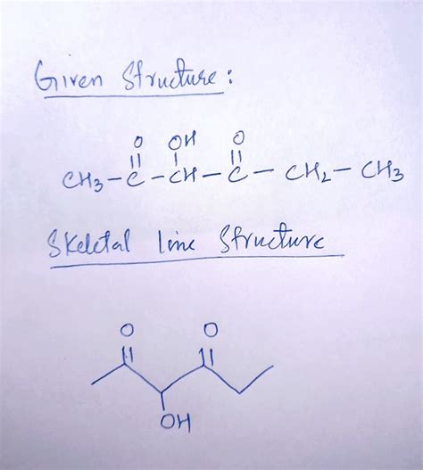 [solved] How To Draw Skeletal Line Draw A Skeletal Line