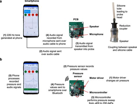 Tympanometry Recommended Procedure At Eddie Avila Blog