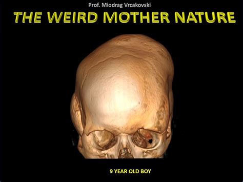 Miodrag Vrcakovski On Linkedin Radiology Skeletalradiology