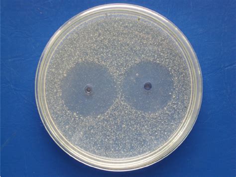 Inhibition Zones Produced By Methanol Extracts Download Scientific