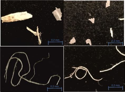 A Subset Of Recovered Microplastics Fibers And Fragments Observed In