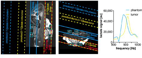 Figure 1 From Hyperpolarized 13c Spectroscopy With Simple Slice And