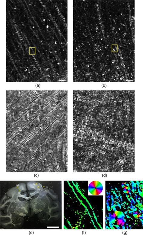 Quantitative Birefringence Microscopy For Imaging The Structural
