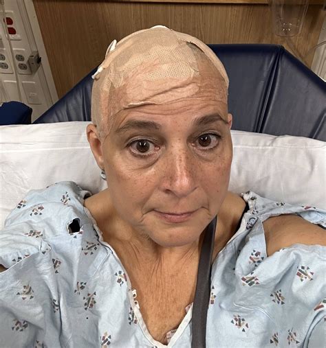 Video Breakthrough In The Fight Against Glioblastoma Mayo Clinic News Network