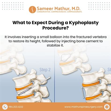 Kyphoplasty Treatment In North Carolina Mathur Spine Surgery