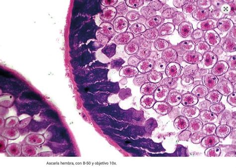 Microscopía Y Cultivo Métodos En Microbiología Baterías Cea