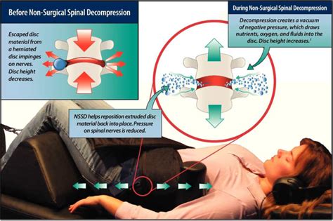 The Decompression Difference