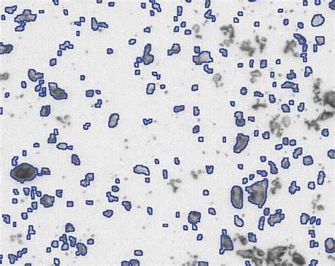 Fertilizer Particle Size And Shape Clemex