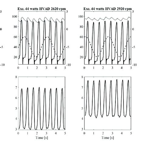 Echo Based Clinical Algorithm For Device Selection In Patients With Echo Based Clinical Algorithm For Device Selection In Patients With