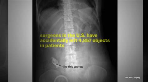 9 Facts About Medical Errors You Should Know Before Entering A Hospital Vox