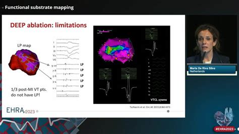 Esc 365 Functional Substrate Mapping