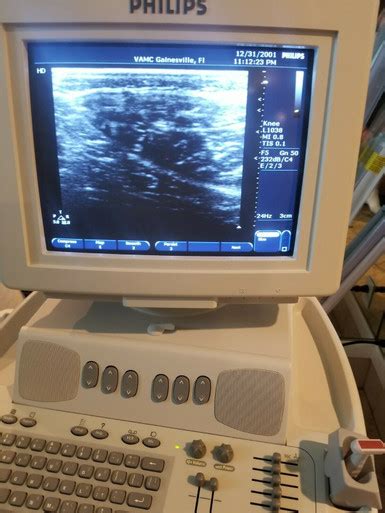 Philips Envisor Hd M2540a Ultrasound Machine With L1038 And 15 6l Probes