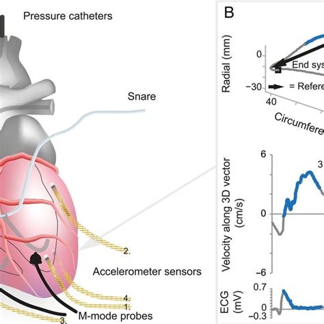 A Schematic Illustration Showing Sensor Placements And Download Scientific Diagram