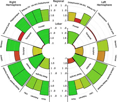 E Representation Of Regional Volumes Quantified With Geodesic