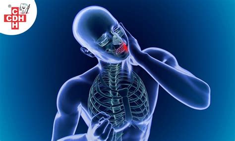 Is Tmj Curable Without Surgery 1 City Dentat Hospital