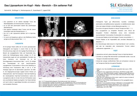 Pdf Liposarcoma Of The Head And Neck A Rare Case