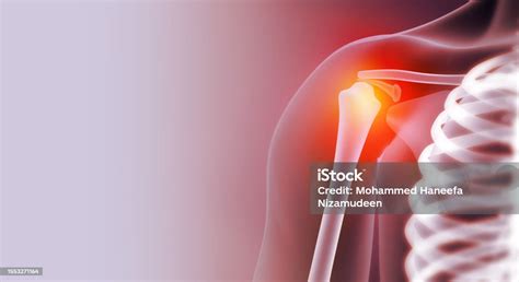 인간의 어깨 관절 통증 X 선 전망 어깨 인대 건염 어깨 근육 긴장 3d 일러스트레이션 근육에 대한 스톡 사진 및 기타 이미지 Istock