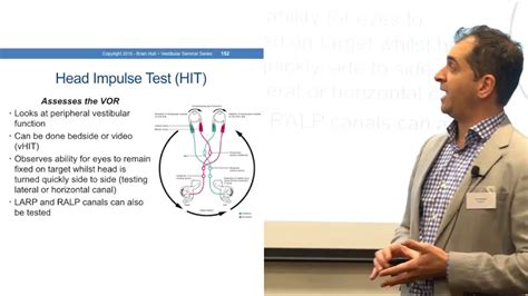 Video Head Impulse Test A Review Of The Literature At Erminia Heavner Blog