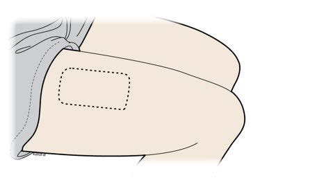 Repatha Package Insert Prescribing Information