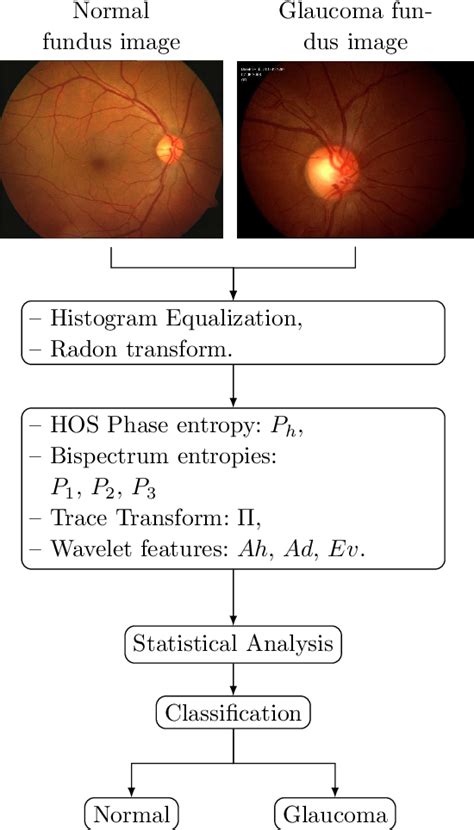figure 1 from automated glaucoma detection using hybrid feature