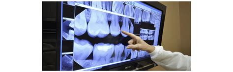 What Are The Benefits Of The Opg Test