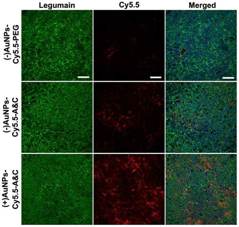 Fluorescence Distribution Of Different Formulations In Tumor Slices