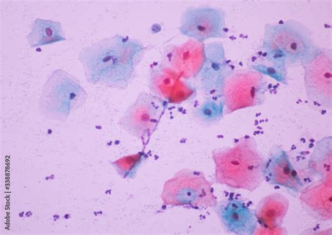 Candida Fungus Slide