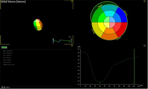 Three‐dimensional Echocardiographic Assessment Of Left Ventricular Download Scientific Diagram