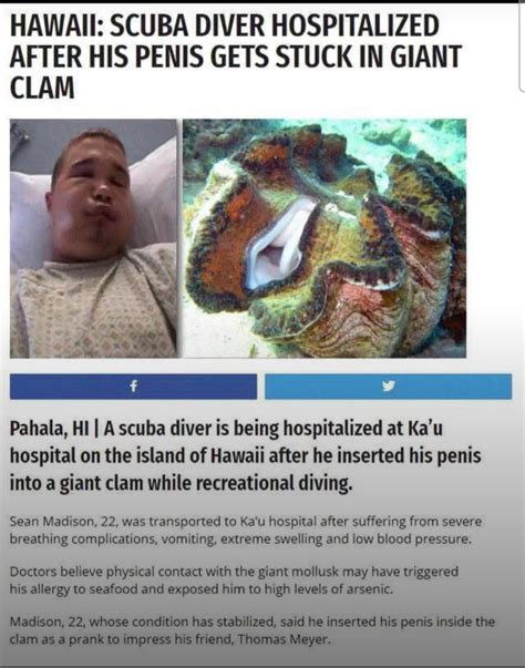 You Have Sex With One Clam And Everybody Says “there Goes Bob The