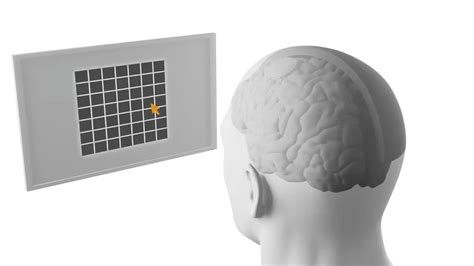 Coming To A Brain Near You A Tiny Computer Wsj Targeted