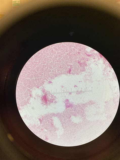 Vibrio Cholerae On Blood Agar Rmicrobiology