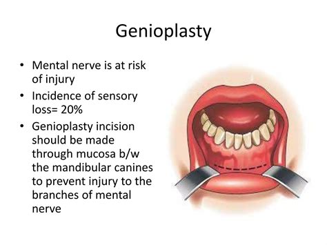 Complications Of Mandibular Orthognathic Surgery Pptx First Aid Injuries