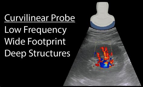 Curvilinear Probe Ultrasound Slide