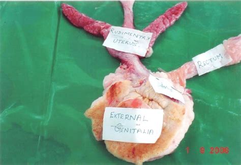 Intersexual Organs