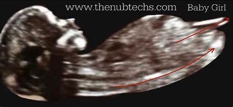 Nub Theory Does It Really Work