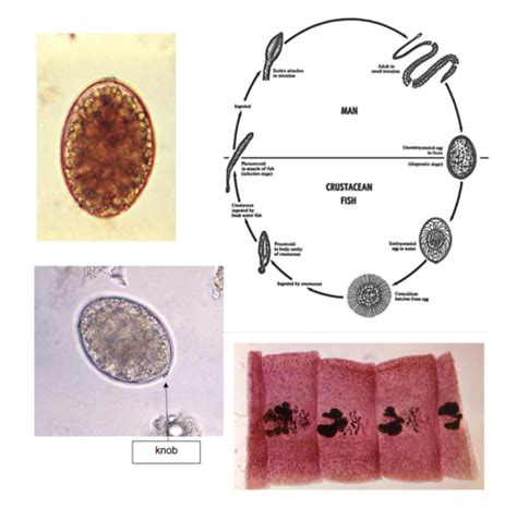 Cestodes Tapeworms Pictures Flashcards Quizlet