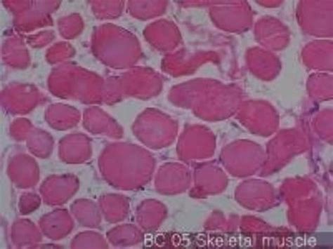 Novus Biologicals Human Multi Tissue Tissue Microarray Cancer Human