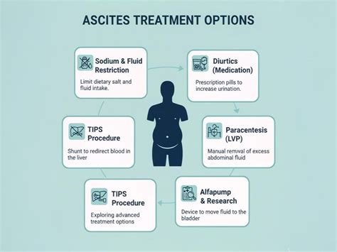 Ascites Treatment How Doctors Manage Fluid Buildup In The Abdomen