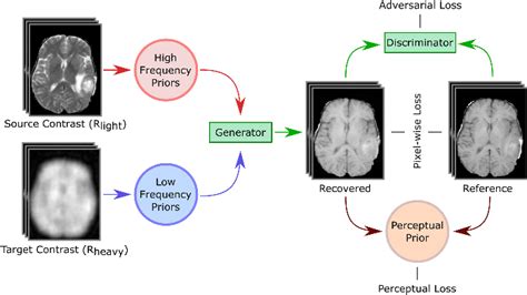 figure 1 from prior guided image reconstruction for accelerated multi
