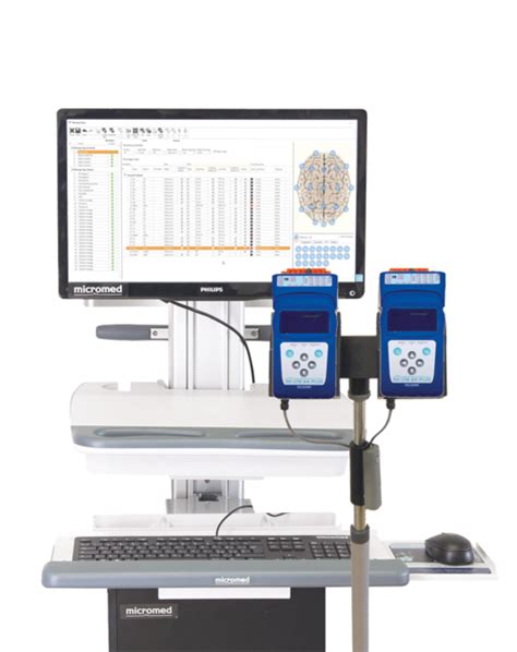 brain quick® ltm eeg system long term video eeg monitoring natus