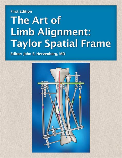 The Art Of Limb Alignment Taylor Spatial Frame Orthopedics