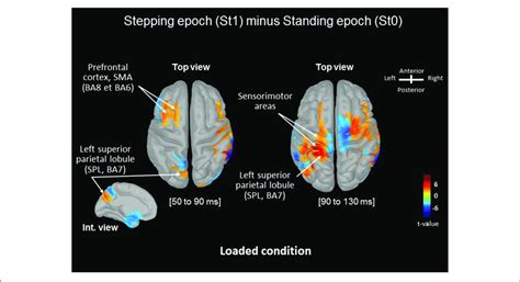 statistical source estimation maps for st1vs st0 contrast i e