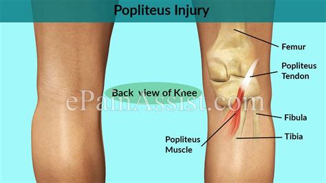 What Is Popliteus Kk Rehab And Therapy Center