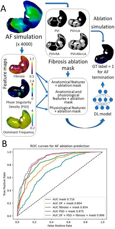 PO ANATOMICAL AND PHYSIOLOGICAL FEATURES IMPROVE AF ABLATION OUTCOME PREDICTION A
