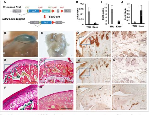 Figure 1 From Selective Role Of Discoidin Domain Receptor 2 In Murine Temporomandibular Joint