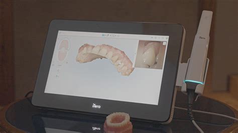 Lighting The Way Align Launches Itero Lumina Scanner Dentistry