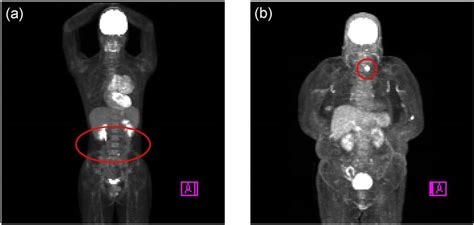 Two Patients A Male B Female Whose Sex Was Incorrectly Predicted Download Scientific Diagram